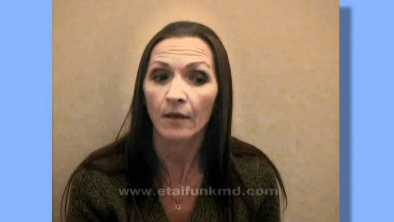 Houston Nasal Surgery Patient Testimonial - Dr. Etai Funk - YouTube