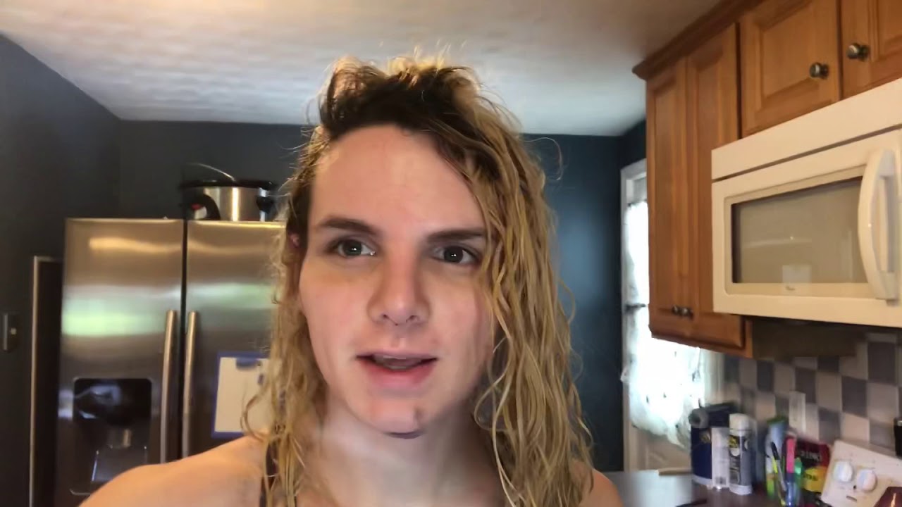 Facial Feminization Surgery (FFS) week 2 recovery update - YouTube