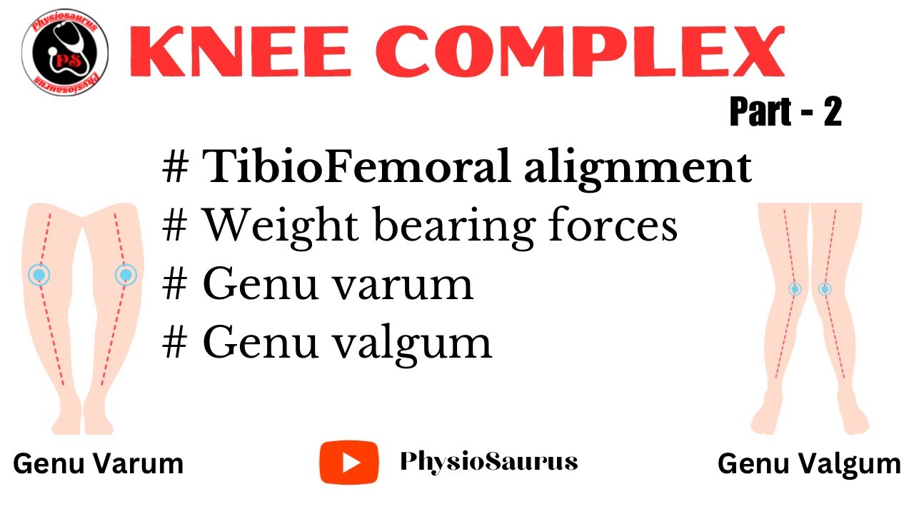 Tibiofemoral alignment and weight bearing forces | Knee joint ...