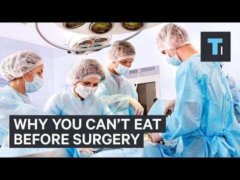 How Long Before Surgery Should You Stop Eating And Drinking