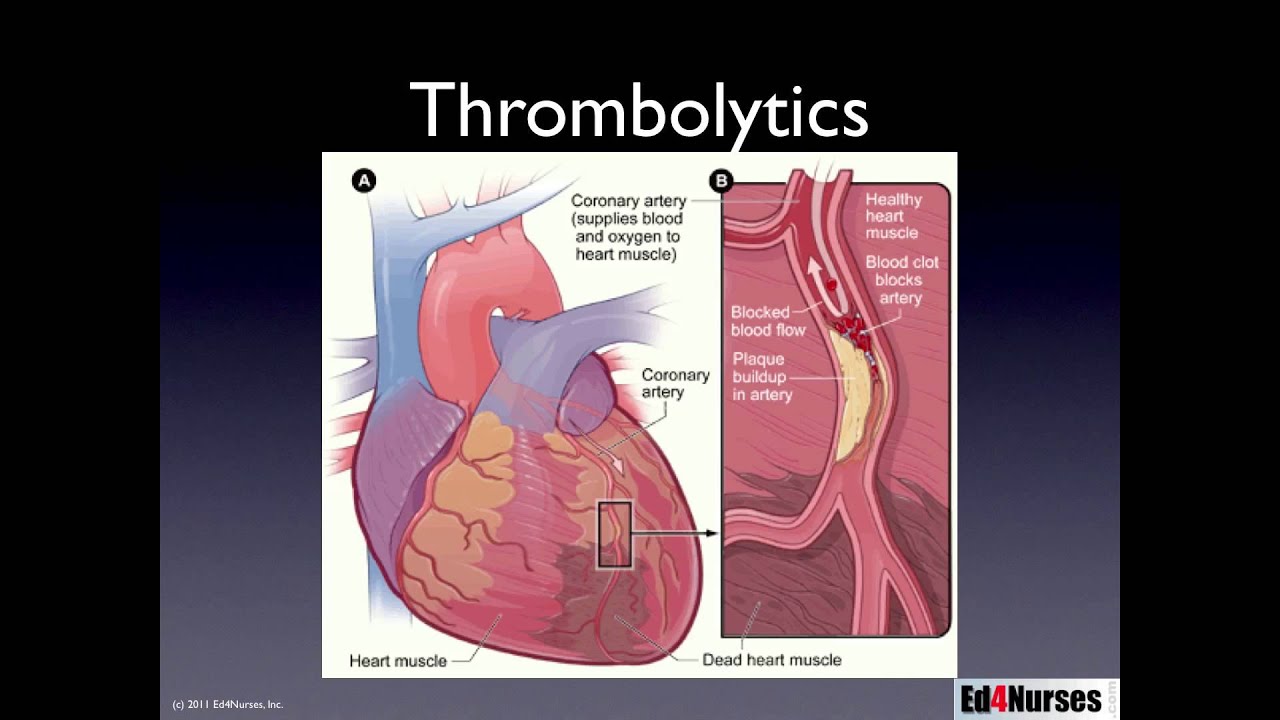 Percutaneous Coronary Interventions - YouTube