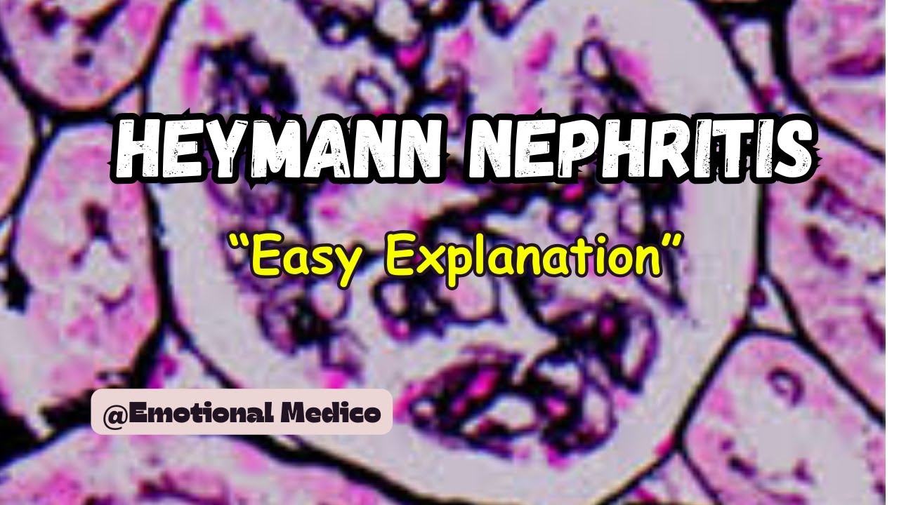 Heymann nephritis - Renal pathology #mediumrobbins @emotionalmedico ...