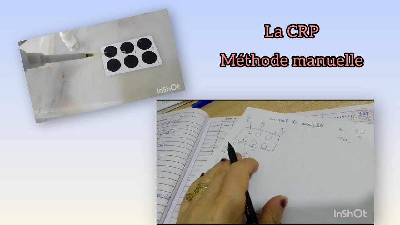 Comment réaliser le test de la CRP( test qualitatif/test quantitatif ...