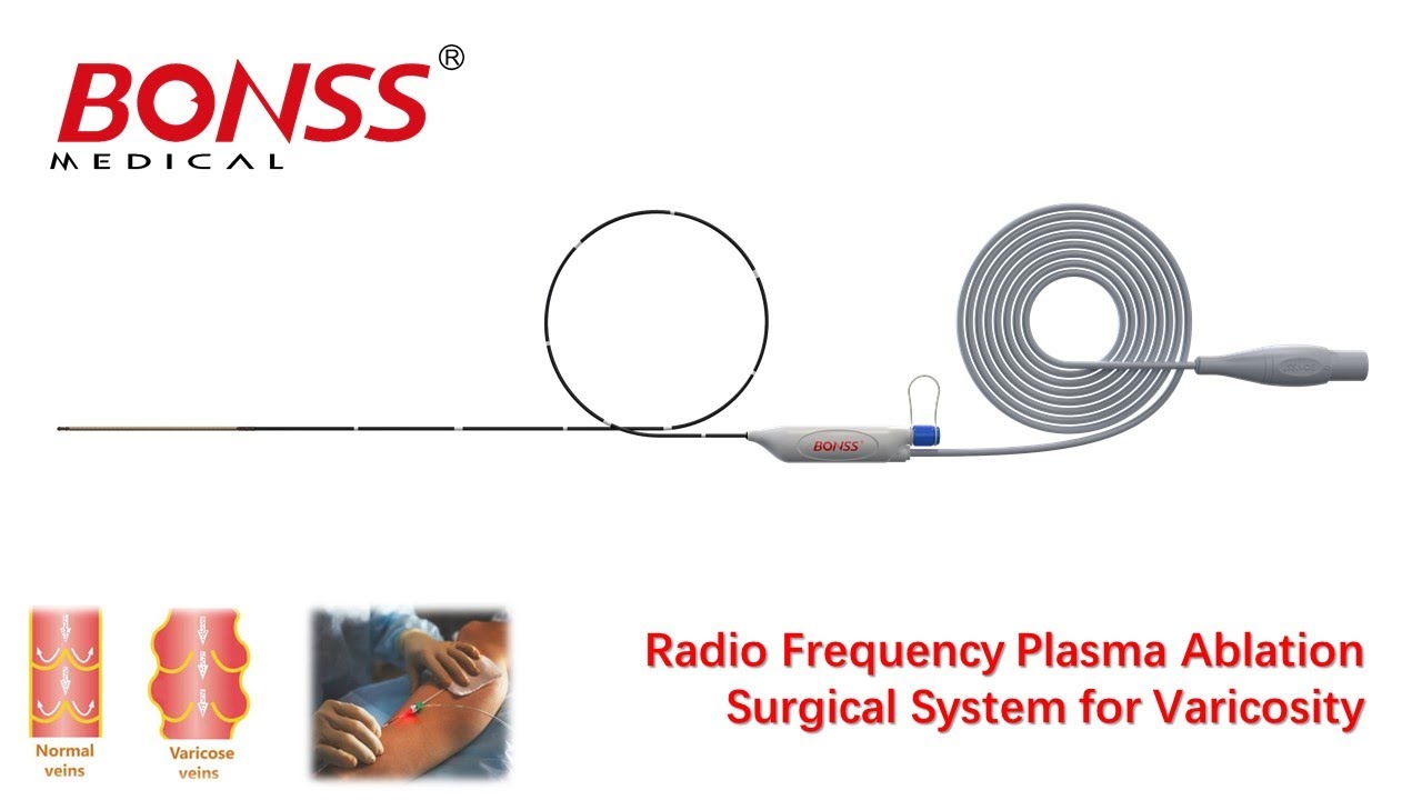 Radio Frequency Plasma Ablation Surgical System for Varicosity - YouTube
