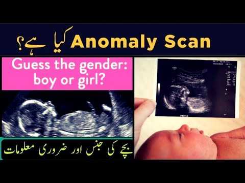Anomaly Scan? | Baby Gender | Baby Boy or Girl |Urdu / Hindi | Health ...