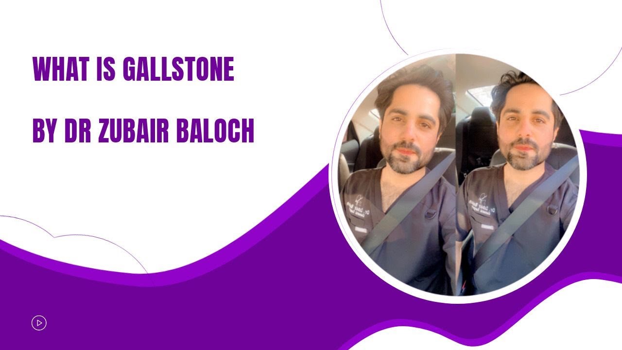 Gall stones Treatment options In Urdu | Laproscopic & open operation ...