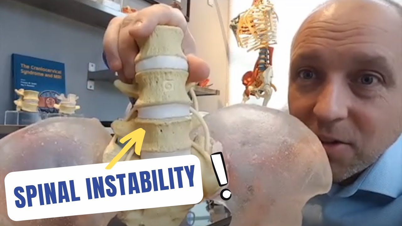 What Is Spinal Instability? - Explaining with Human Anatomical ...