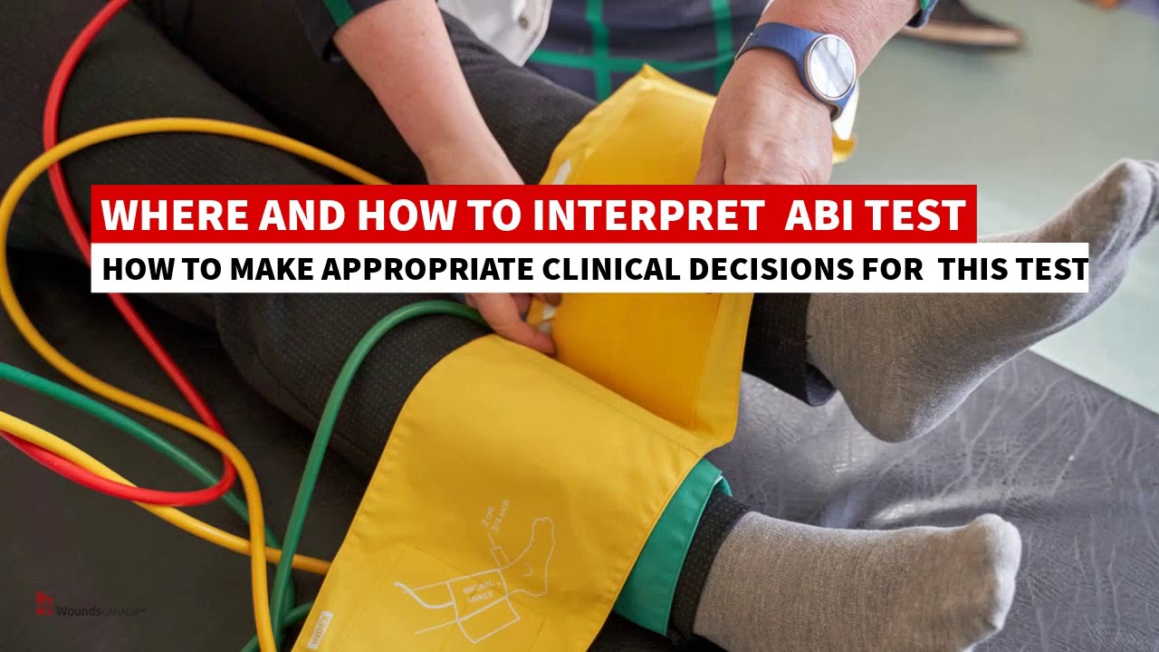 ABI Test in the management of people with chronic leg ulcers due to ...