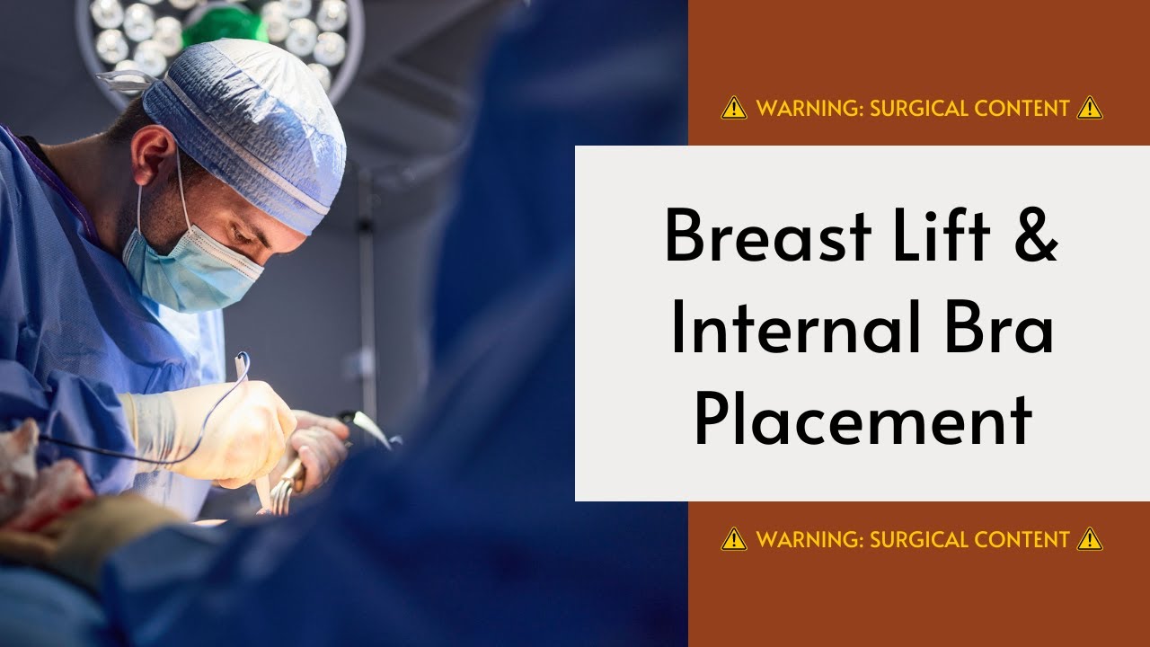 #surgeryday Videos: Breast Lift & Internal Bra Placement - YouTube