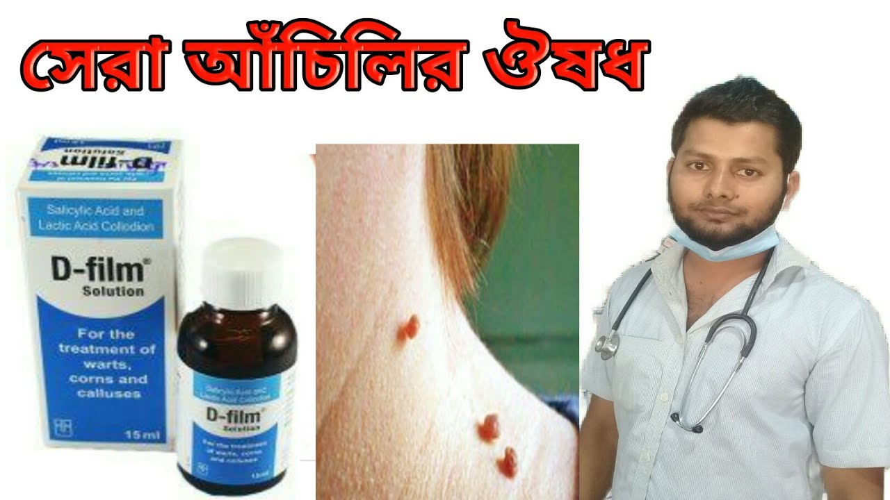 আঁচিলের ঔষধ।D-film lotion.BD pharmacy. - YouTube