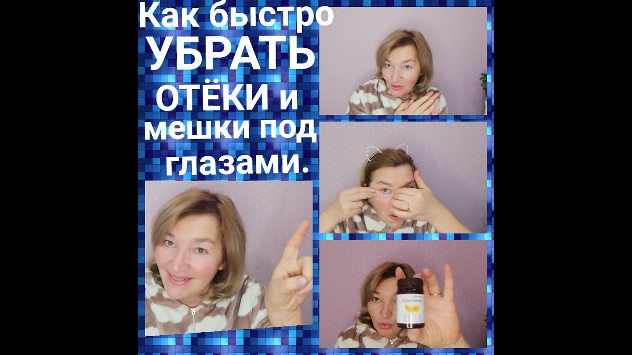 Как БЫСТРО убрать МЕШКИ и ОТЁКИ под глазами в ДОМАШНИХ УСЛОВИЯХ Youtube