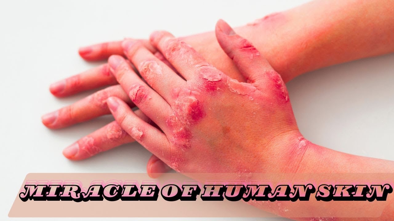 The Quran and Medical Science: How Allah Designed the Skin to Heal ...