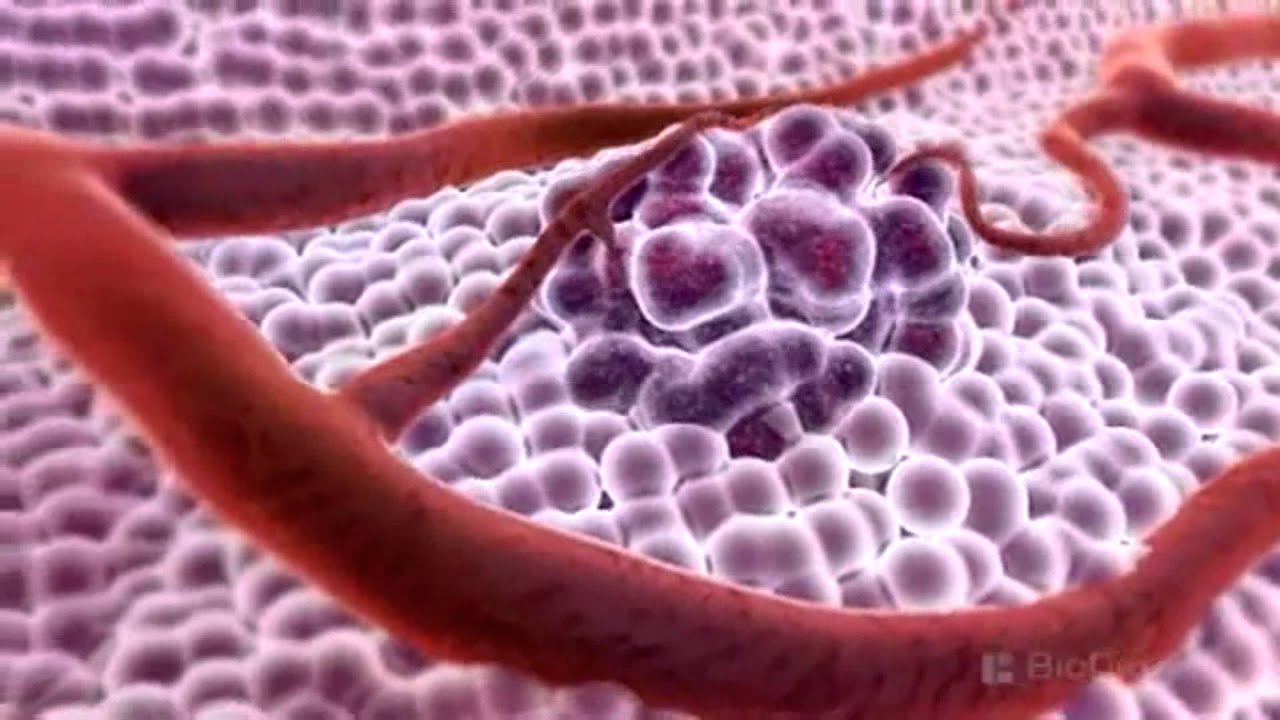 3D Medical Animation What is Cancer - YouTube