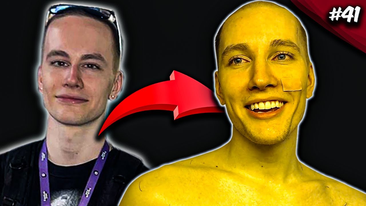 The Day I Became Bald... Velcuz Highlights #41 - YouTube