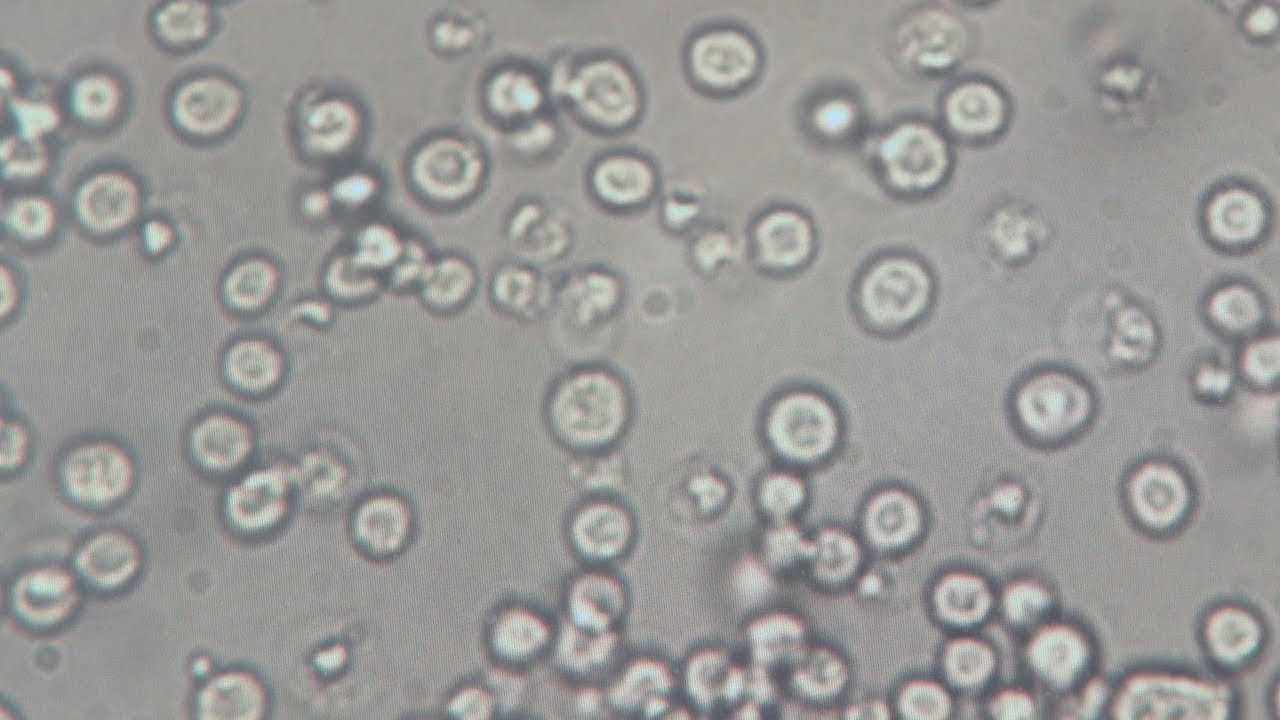 Mono Virus Discovery | Cincinnati Children's - YouTube