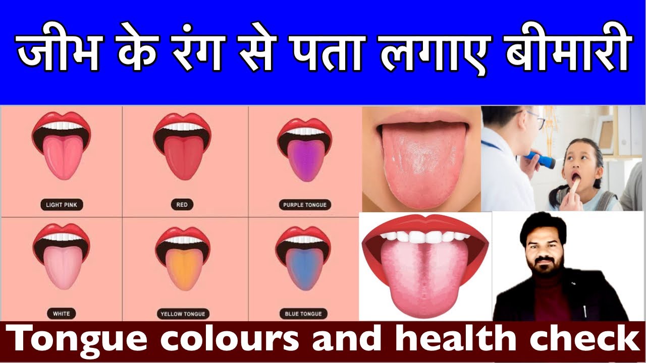 जीभ(Tongue) के रंग से जाने सेहत का हाल / Tongue colors, signs and ...