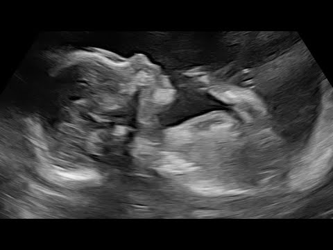Bebek Odası ve Bebek Hediyeleri - Bölüm 1 | HelintheNester