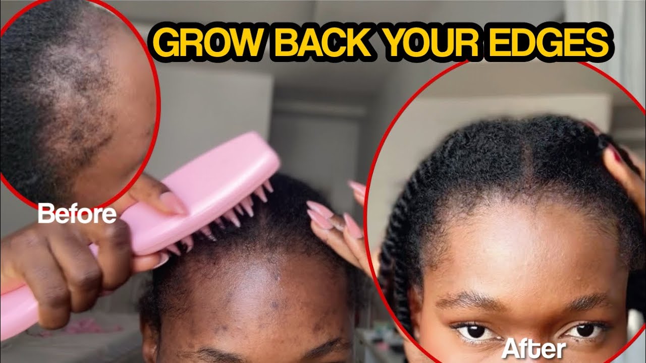 HOW TO GROW BACK EDGES | how to scalp massage for hair growth - YouTube