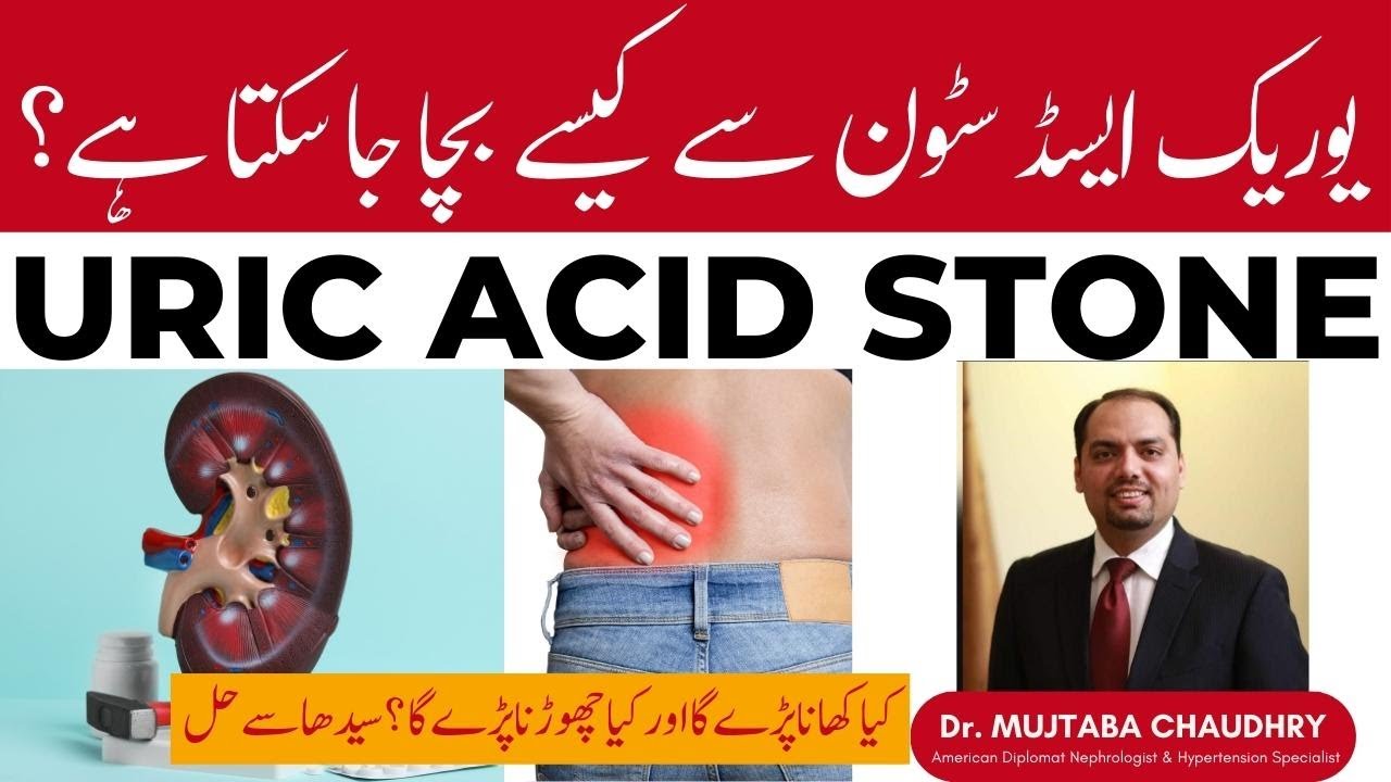 Uric Acid Stone | Uric Acid ka ilaaj | Treat Uric Acid | Foods For High ...