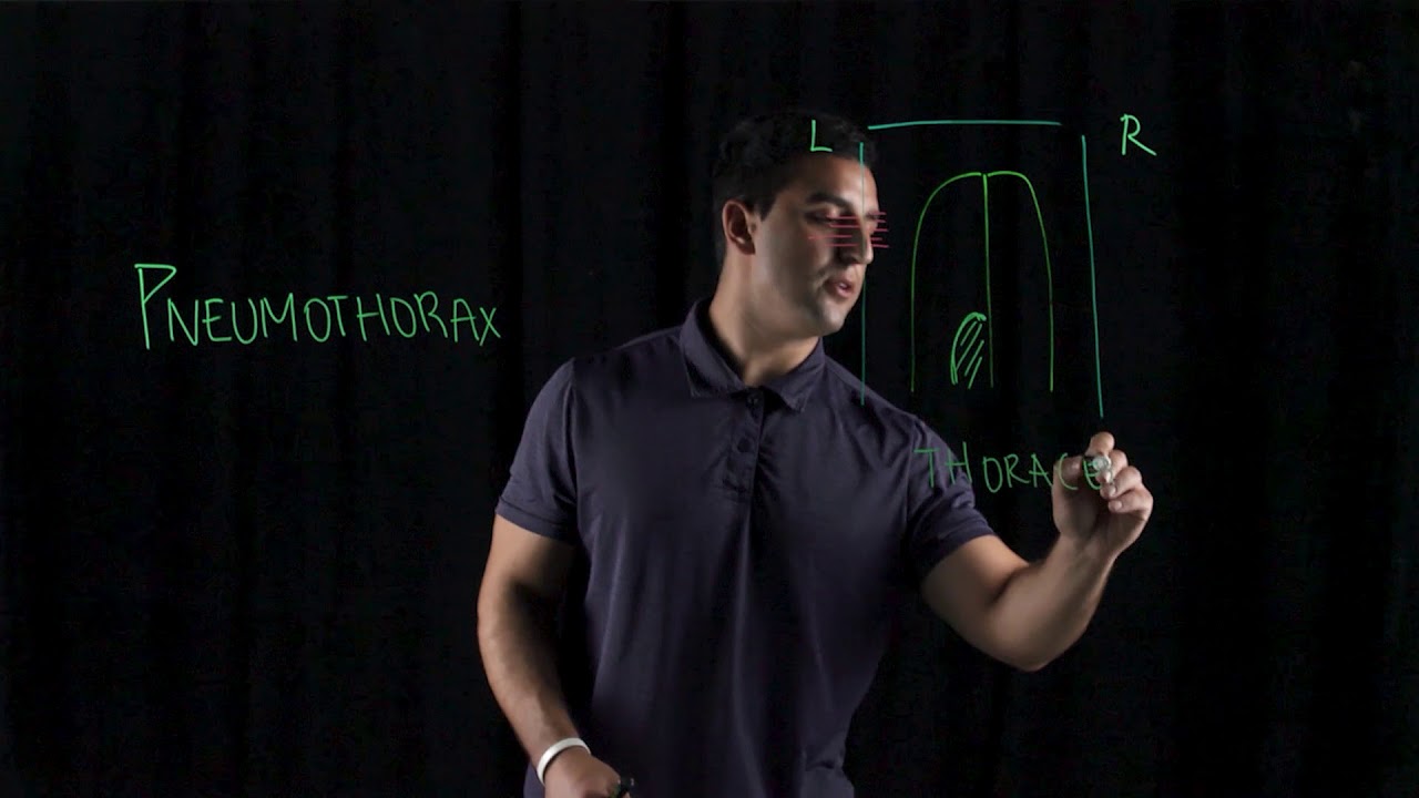 Pneumothorax Youtube