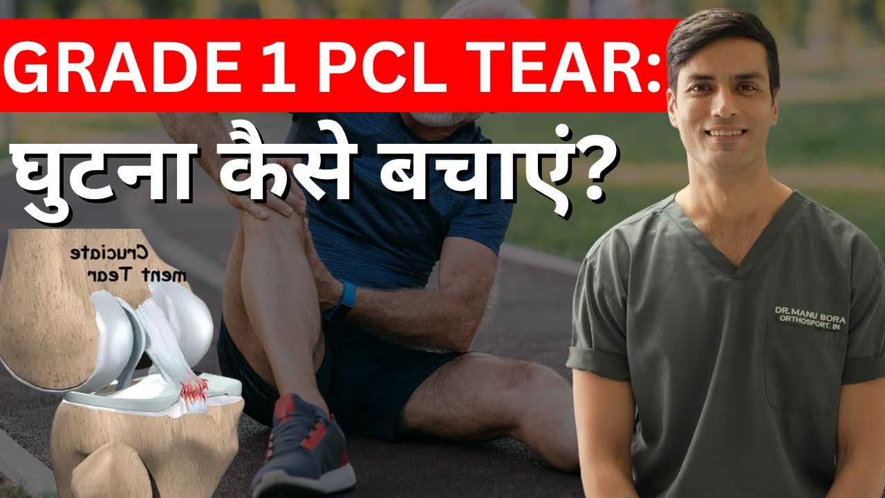 Grade 1 PCL Tear: घुटना कैसे बचाएं? || Grade 1 PCL Tear: How to save ...