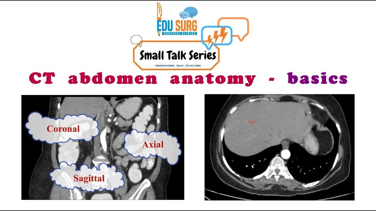 CT Abdomen anatomy - Radiology lectures - small talk series - Edusurg ...