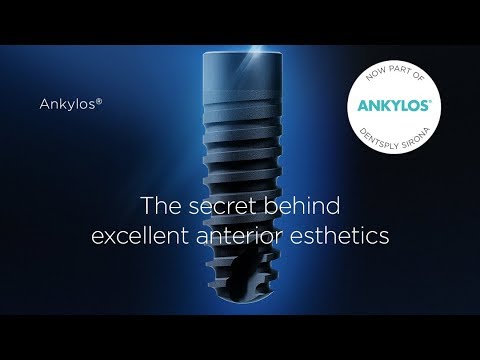 Ankylos the secret behind excellent anterior esthetics - YouTube