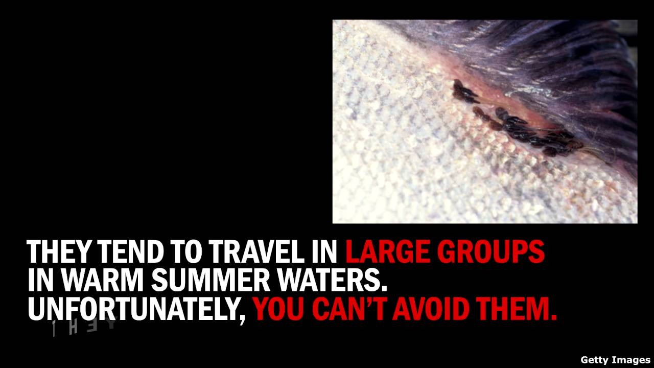 Sea Lice and the rash they cause - YouTube