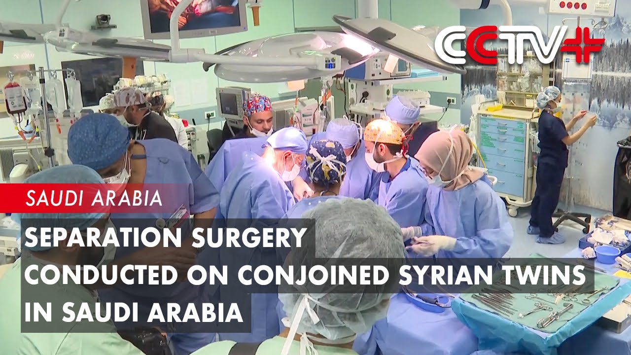 Separation Surgery Conducted on Conjoined Syrian Twins in Saudi Arabia ...