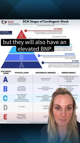 SCAI Shock Stages - B - YouTube