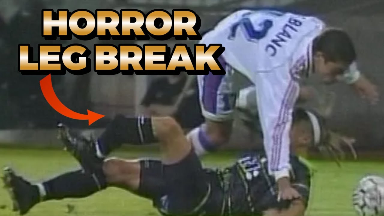 The WORST LEG BREAK in Football HISTORY! - YouTube