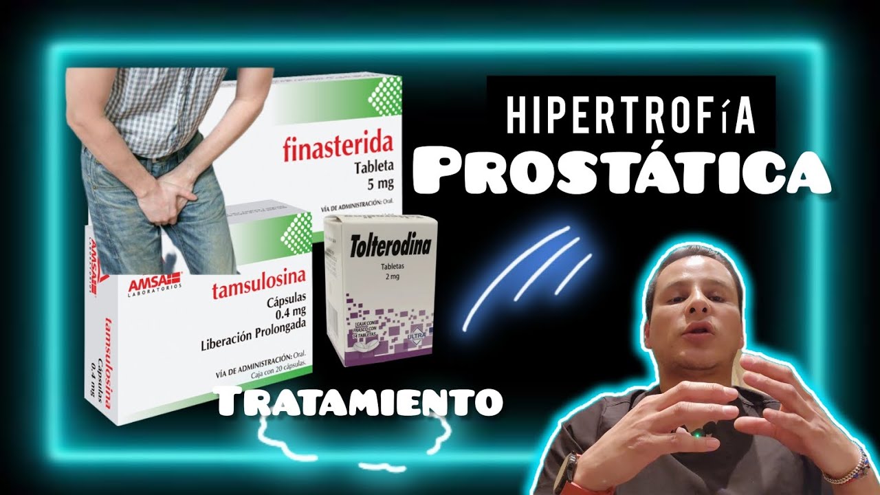Finasterida y Tamsulosina - Hipertrofia Prostatica Benigna Tratamiento ...