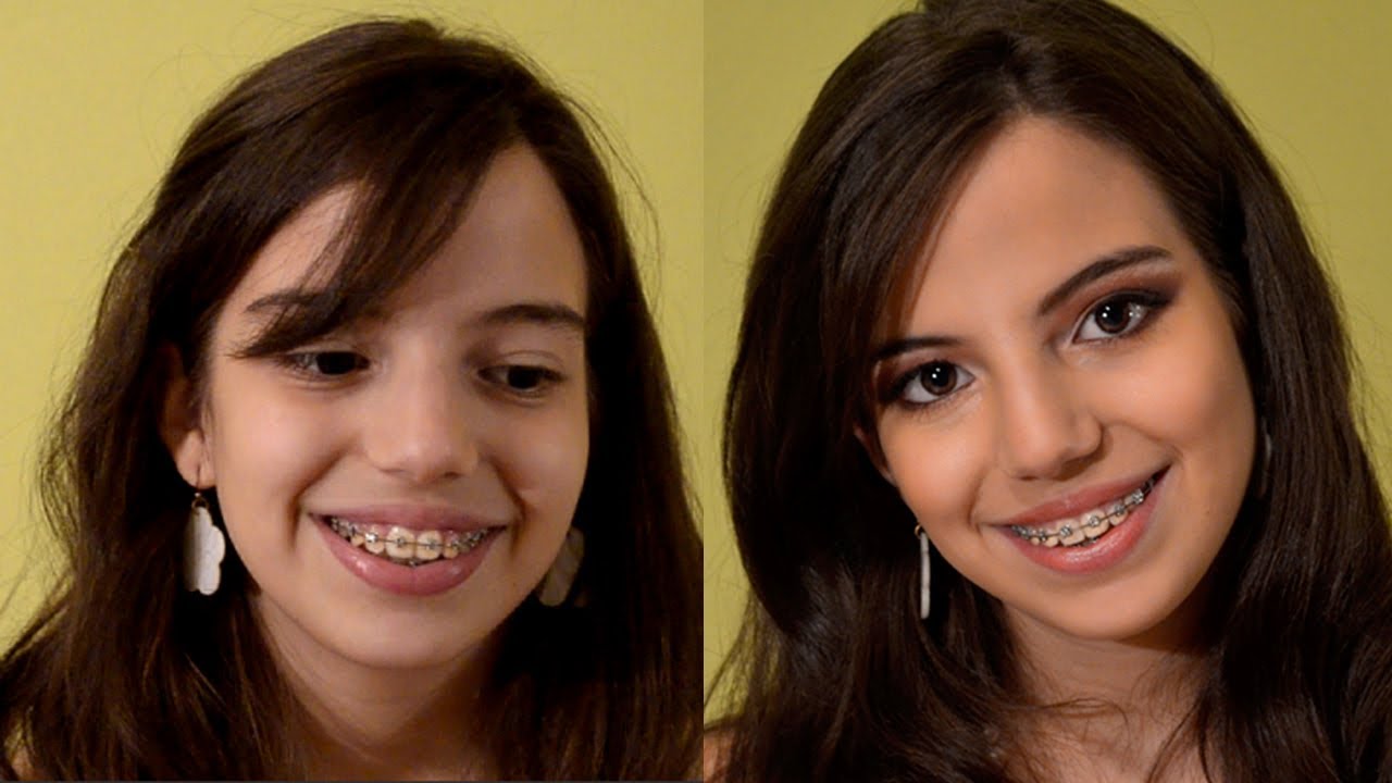 Makeup for braces - YouTube