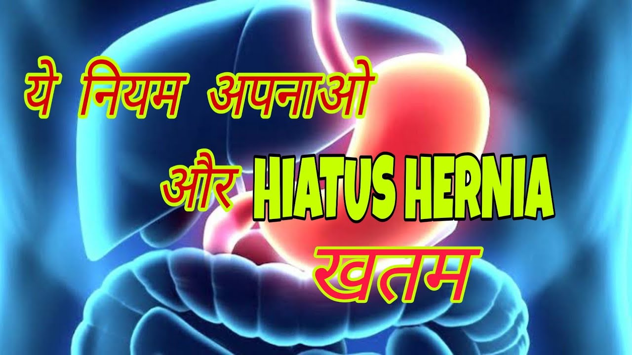 Hiatus hernia ka ayurvedic upchar || Rule for hiatus hernia in Hindi ...