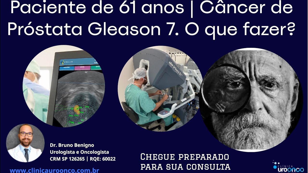 61 anos com Câncer de Próstata Gleason 7 | O que fazer? Como orientamos ...