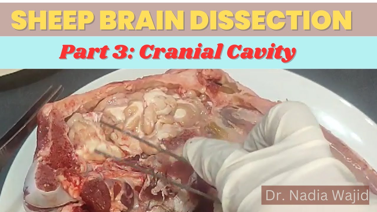 Brain Dissection Sheep - YouTube
