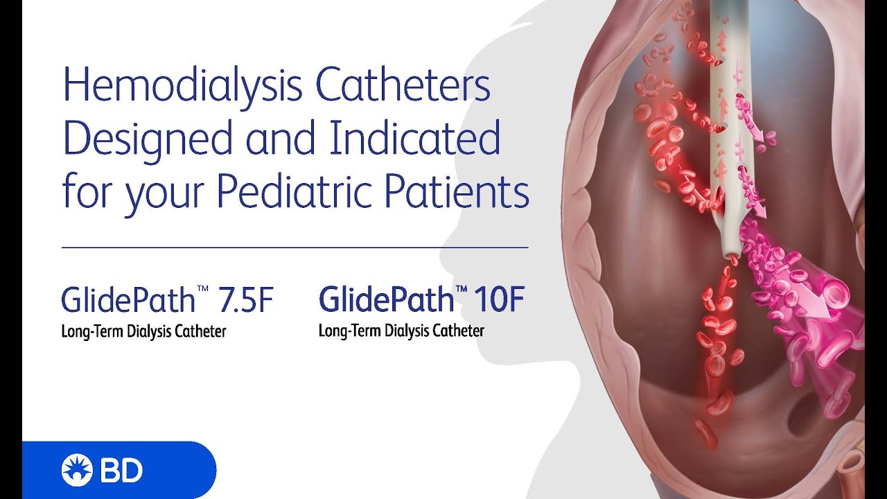 BD GlidePath™ 7.5F and 10F Long-Term Hemodialysis Catheter Procedural Animation (no audio) - YouTube