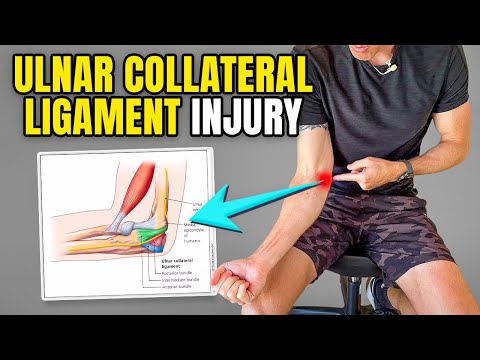 How To Rehab A Ulnar Collateral Ligament