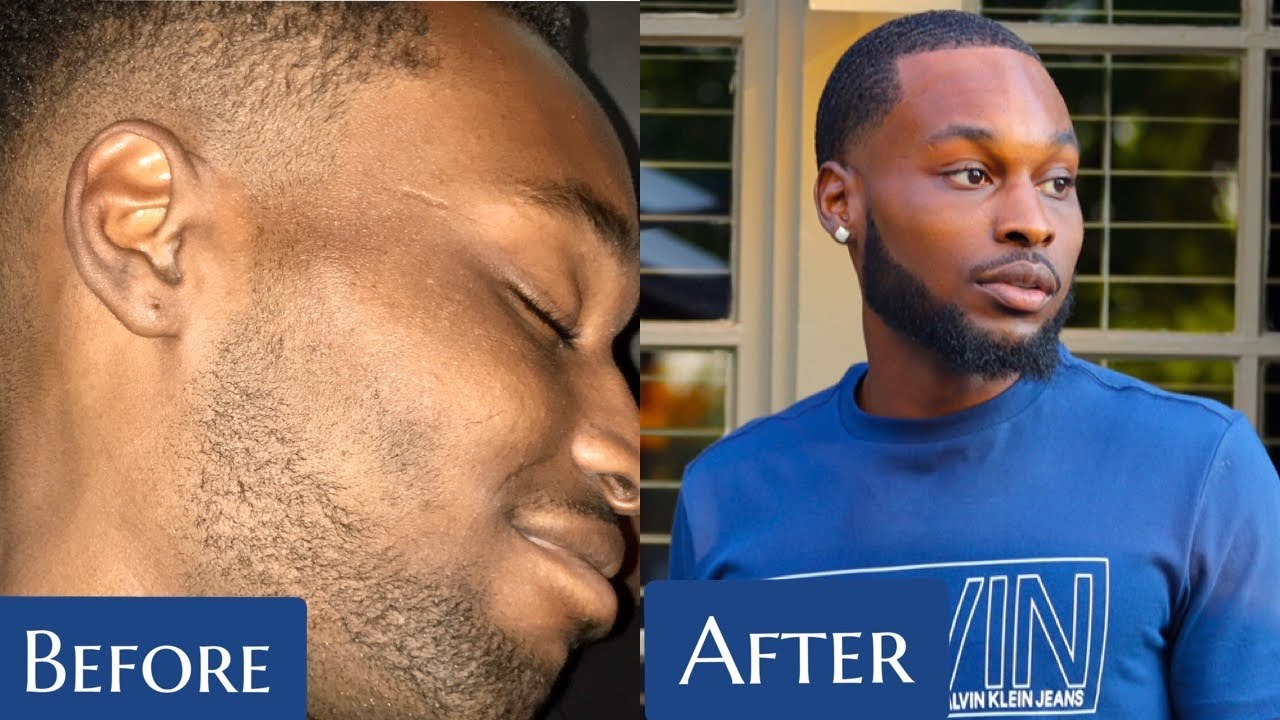 HOW TO GROW A BEARD FAST! 😳 - YouTube