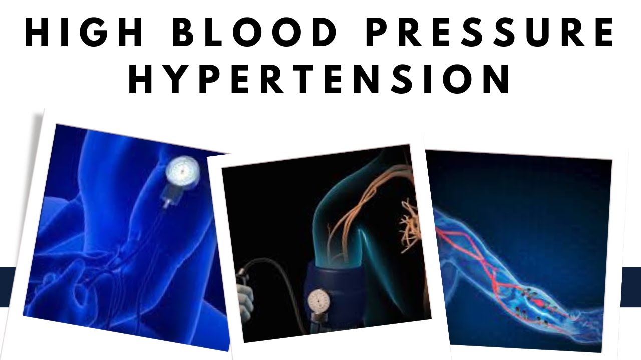 High Blood Pressure (Hypertension) Animation - YouTube