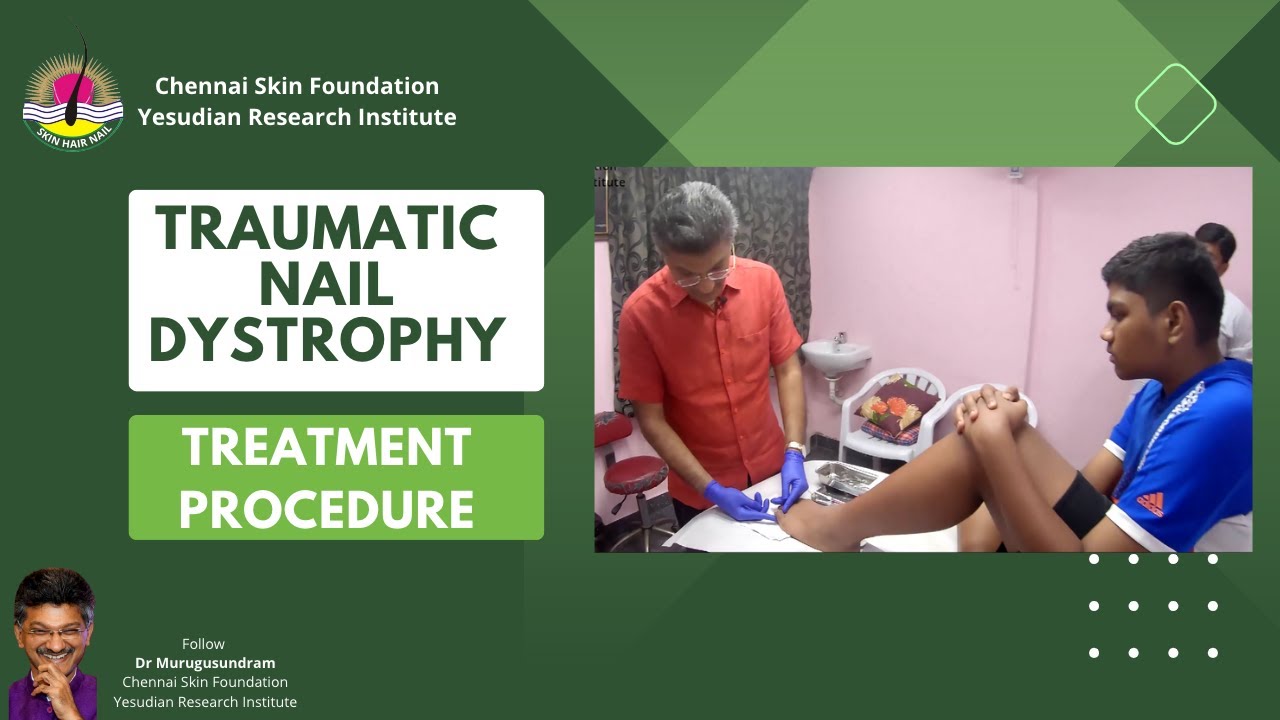 Transforming a Soccer Player's Toe: Nail Dystrophy Procedure and ...