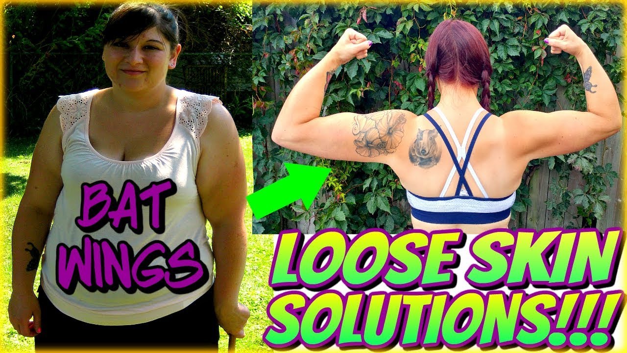 NATURAL LOOSE SKIN SOLUTIONS AFTER EXTREME WEIGHT LOSS (BAT WINGS ...