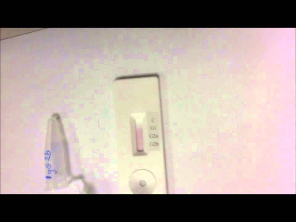 Rapid Mouse antibody Isotyping Kit IgG2b - YouTube