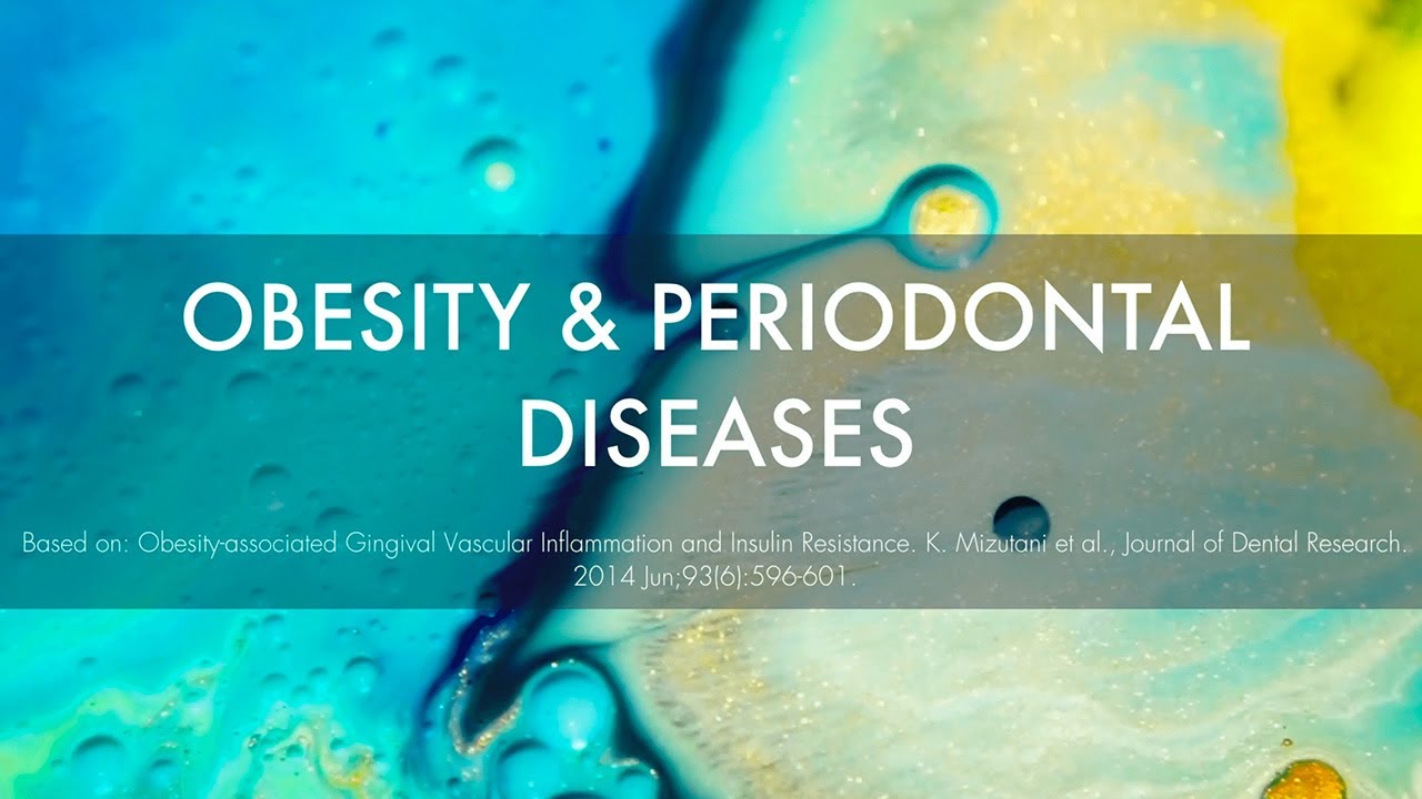 Obesity & Periodontitis - YouTube