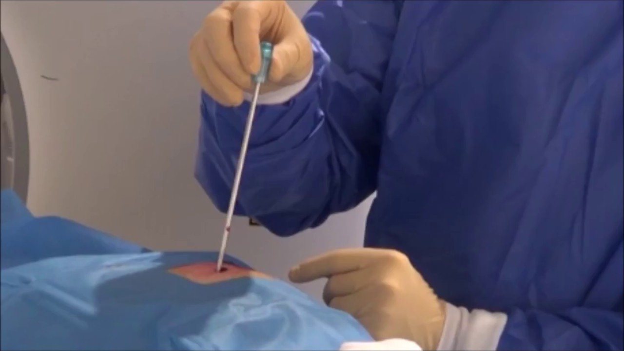 Spirotome - YouTube