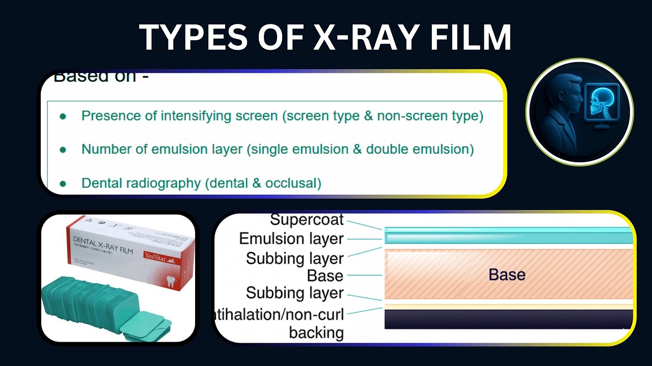 TYPES OF X RAY FILM | SCREEN TYPE & NON-SCREEN TYPE #xray #radiology # ...