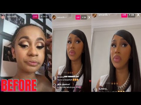 Cardi B talks about plastic surgery she had on her face gives advices ...
