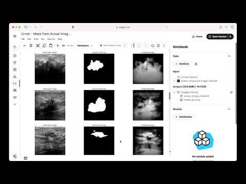 A Kaggle session on medical image segmentation by a U-Net - YouTube