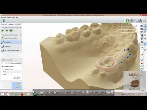 How to design a Band and Loop Space Regainer in 3Shape - YouTube