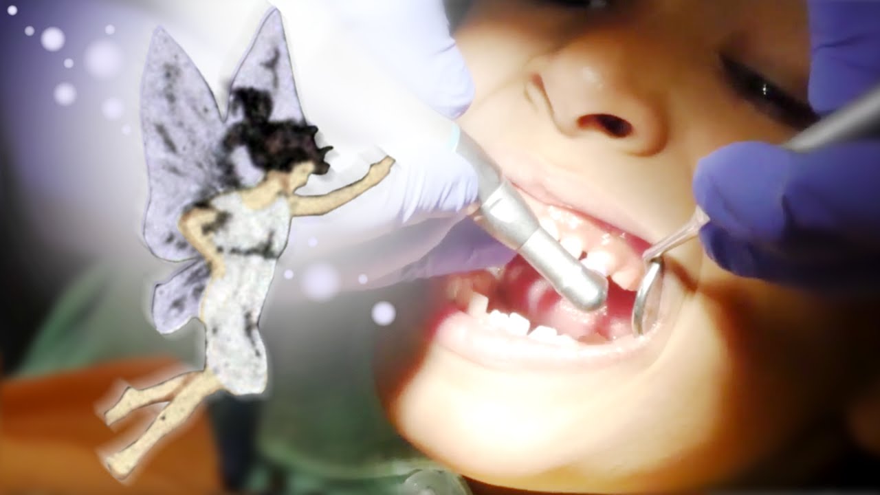 How To Prep for the TOOTH FAIRY & First Dentist Visit - SHARK TOOTH ...